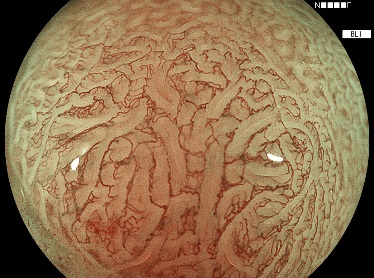 Library - Endoscopy - SeeLearn Europe
