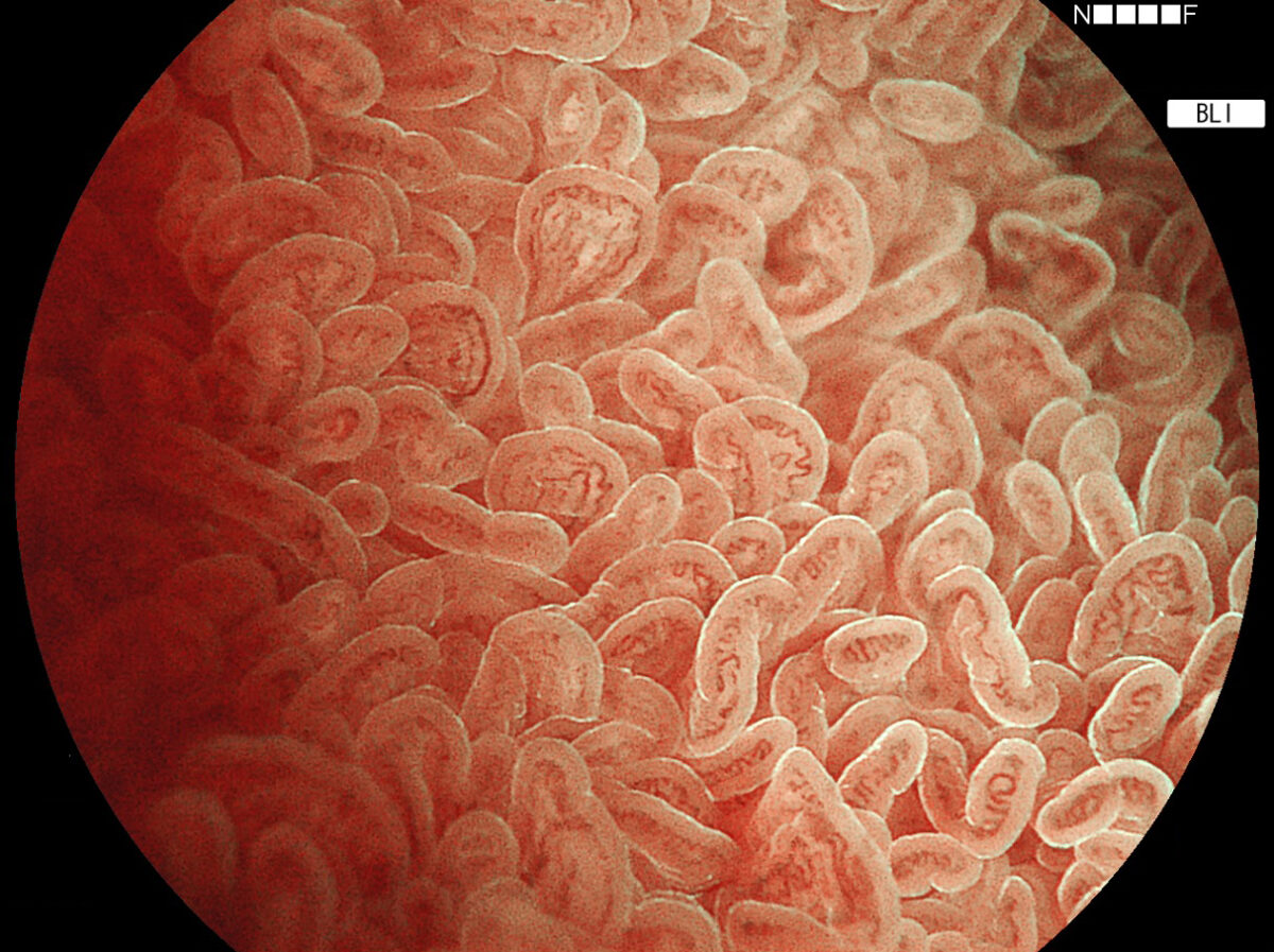 Library - Endoscopy - SeeLearn Europe