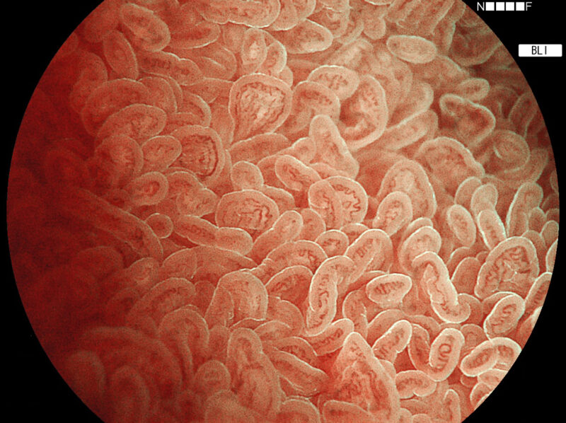 Library - Endoscopy - SeeLearn Europe