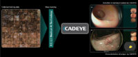 Cad Eye - Endoscopy - SeeLearn Europe