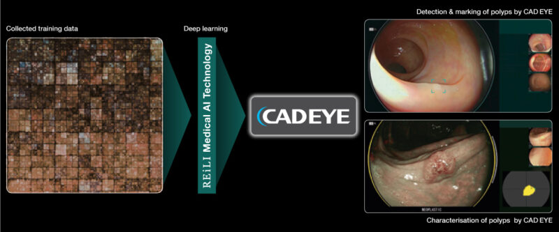 Cad Eye - Endoscopy - SeeLearn Europe