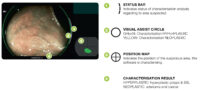 Cad Eye - Endoscopy - SeeLearn Europe