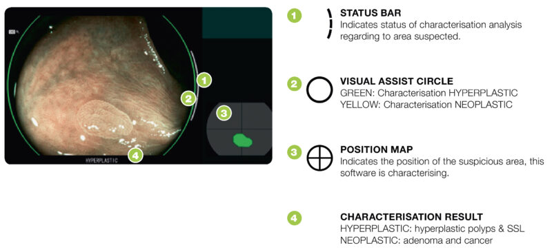 Cad Eye - Endoscopy - SeeLearn Europe