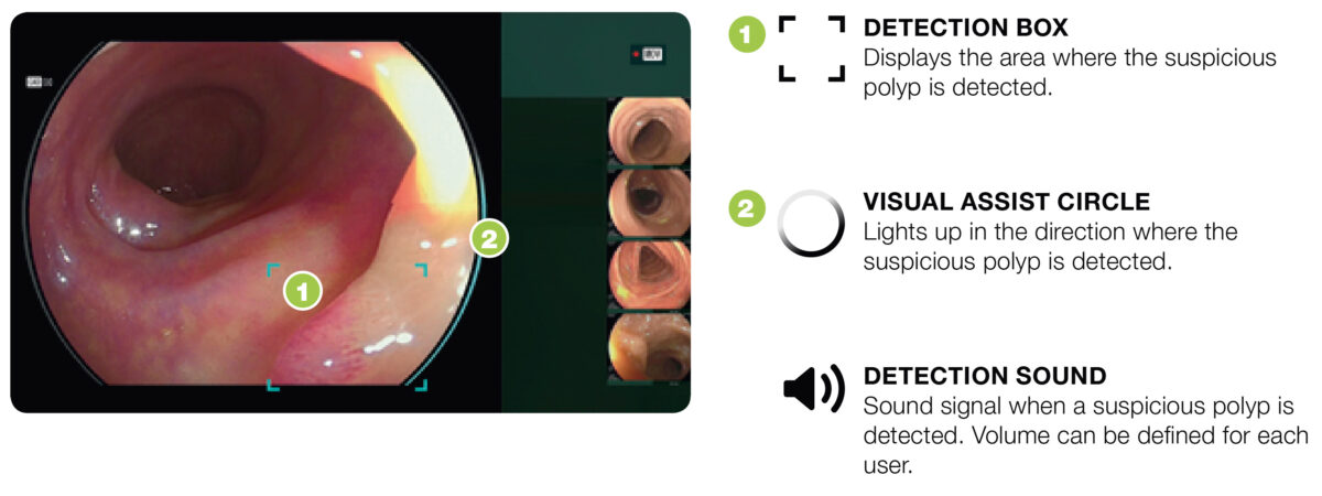 Cad Eye - Endoscopy - SeeLearn Europe