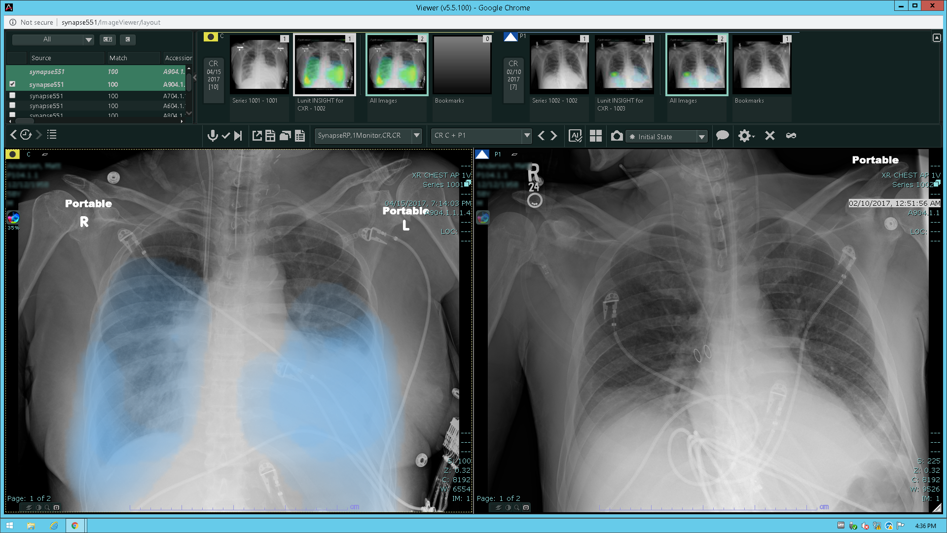 During the emergency, ASST Vimercate Hospital chose REiLI, Fujifilm’s ...