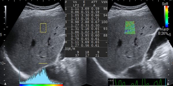 Home - Ultrasound Radiology - SeeLearn Europe