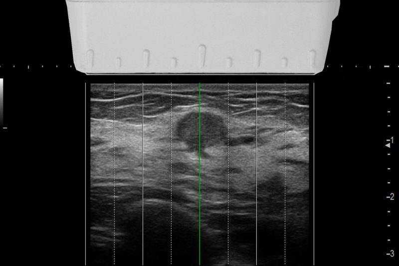 Home - Ultrasound Radiology - SeeLearn Europe