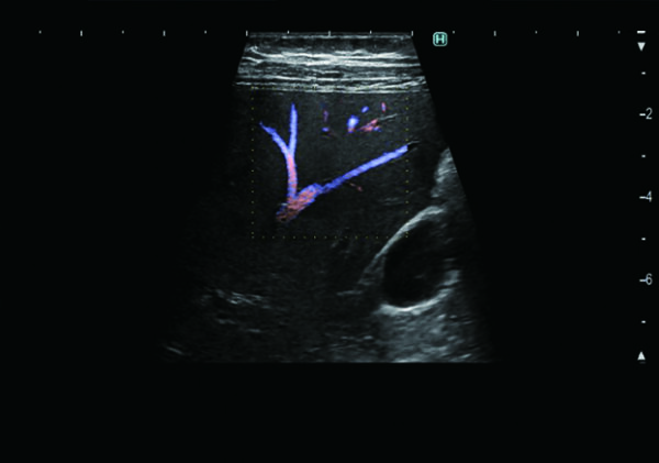 4G CMUT - SeeLearn Europe