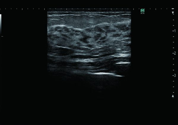 4G CMUT - SeeLearn Europe