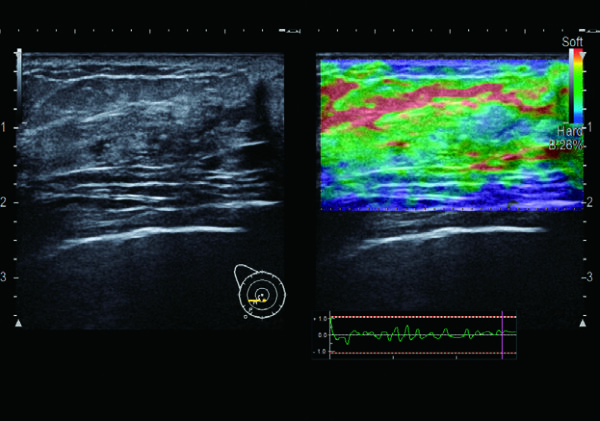 4G CMUT - SeeLearn Europe