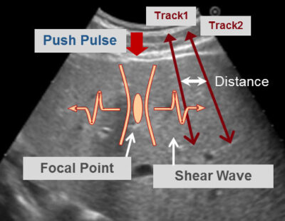 Technology (SWM) - SeeLearn Europe