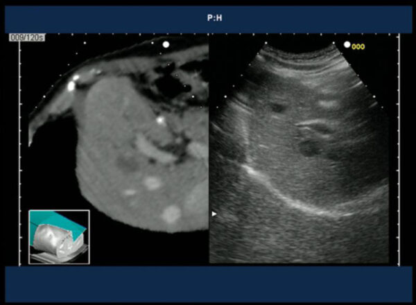 Real-time Visual Sonography (RVS) - SeeLearn Europe