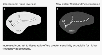 Dynamic Contrast Harmonic Imaging (dCHI) - DRAFT - SeeLearn Europe