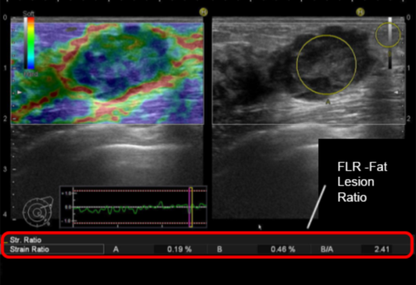 Elastography - SeeLearn Europe