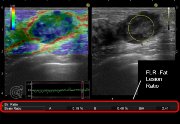 Elastography - SeeLearn Europe